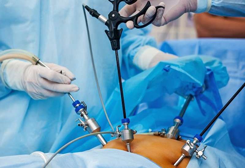 Advanced Laparoscopic Surgery in Bangalore - A.V. MULTISPECIALITY HOSPITAL